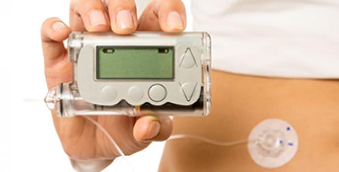 What is CGM and How Does it Help Manage Diabetes? | Beebe Healthcare